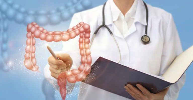 Sindromul de colon iritabil: cauze, simptome, tratament medical şi posibile remedii naturale ...